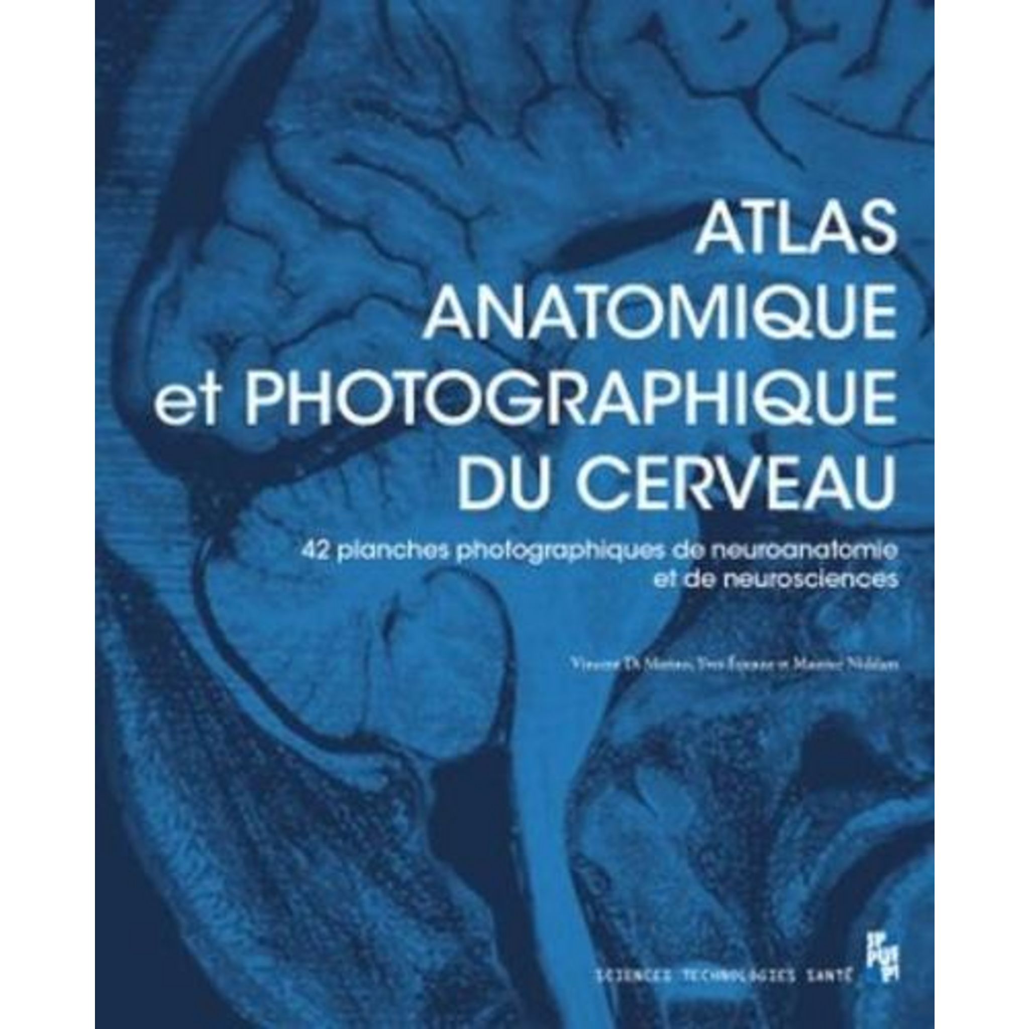 ATLAS ANATOMIQUE ET PHOTOGRAPHIQUE DU CERVEAU. 42 PLANCHES (DONT 41 ...
